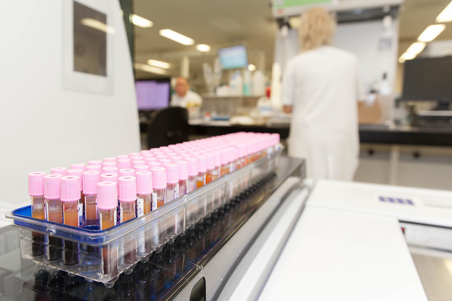 DPYD-genotypering: een nieuwe test om ernstige toxiciteit te voorkomen ...