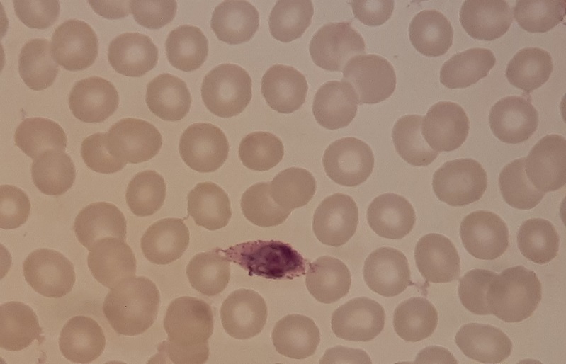 Publicatie van afdeling moleculaire diagnostiek in Tijdschrijft voor ...