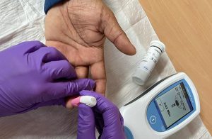 INR waarden trombosepatiënten bepalen met vingerprik - Resultlaboratorium